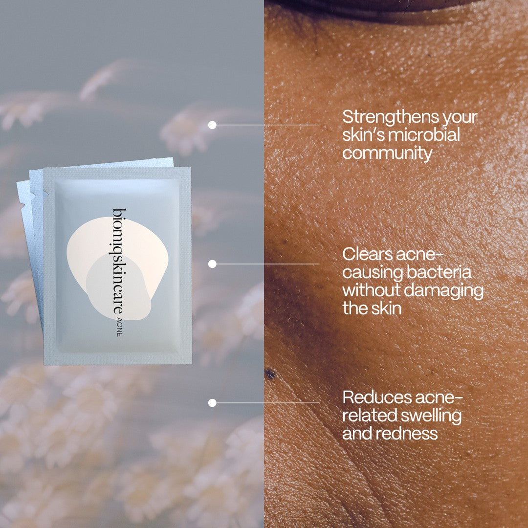 Clear Skin Acne Bundle - Your Complete Acne Solution – biomiq