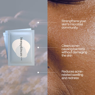 Acne Wipes – biomiq