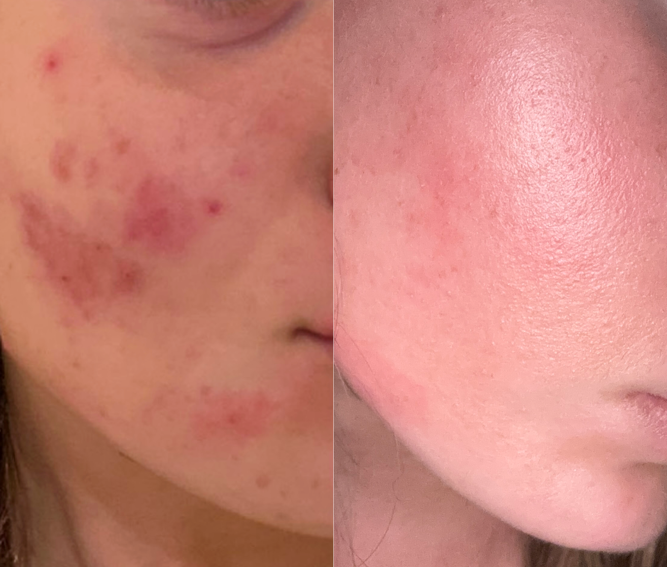 Hydrating Soothe Serum – Calm and Nourish Your Skin – biomiq