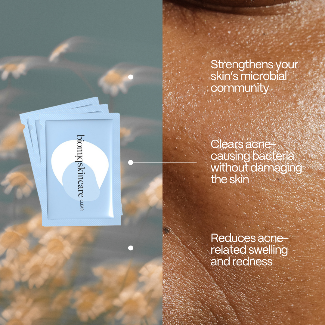 Rapid Clear Acne Wipes - Convenient Acne Control – biomiq